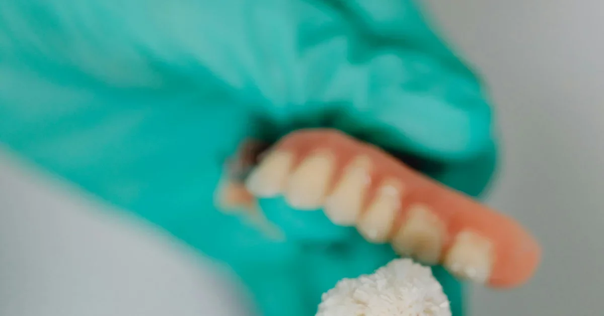 Update on Removable Partial Denture (RPD) Therapy | UCLA School of Dentistry